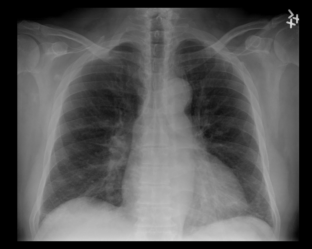 On Call Radiology Common Radiology Findings On Call And In The On Call Radiology Common Radiology Findings On Call And In The